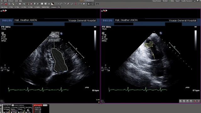 RSNA 2022 | Visage's Top Five