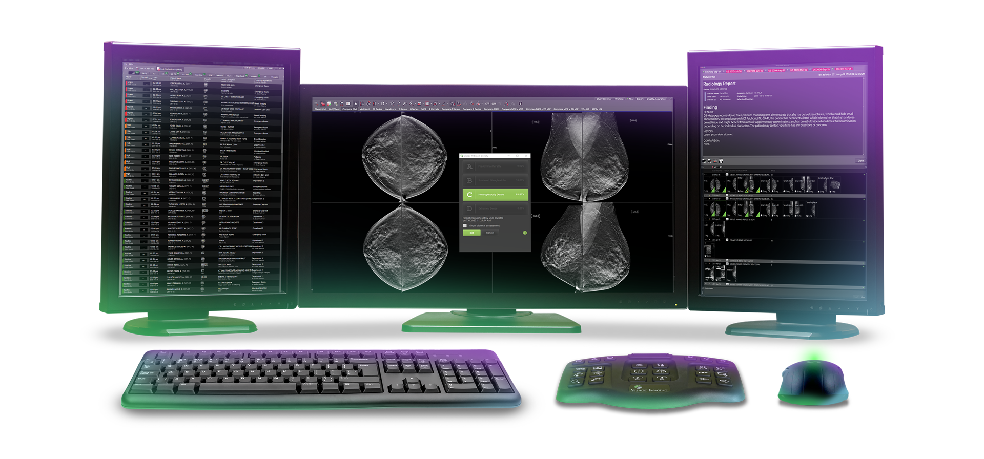 Visage Breast Density AI Classifier – From Conception to Routine Use