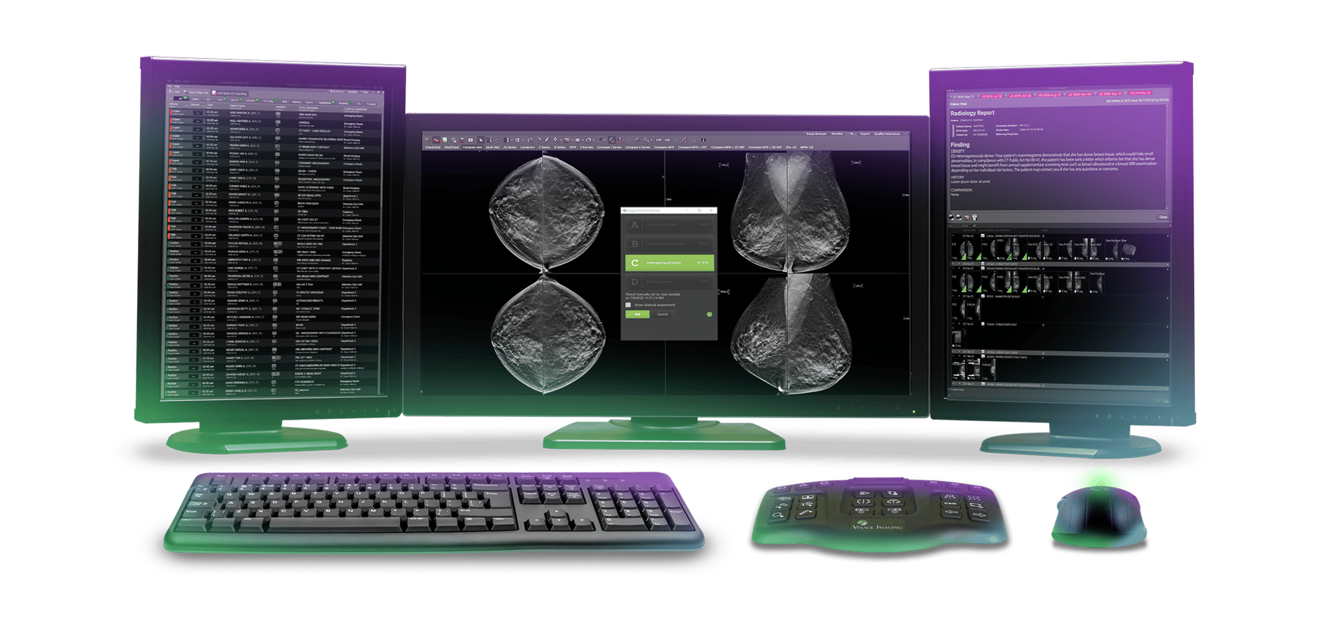 Visage Breast Density AI Classifier – From Conception to Routine Use