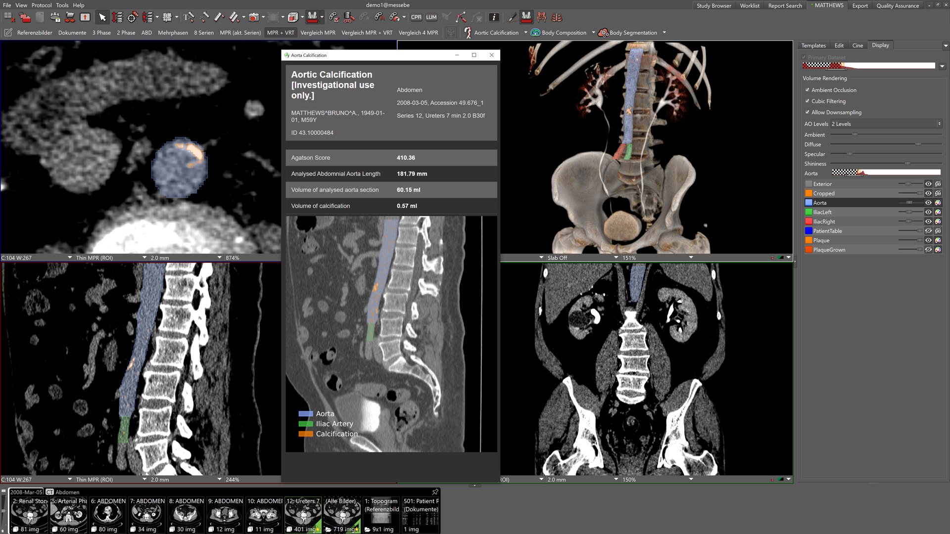 RSNA 2024 | Visage's Top Five