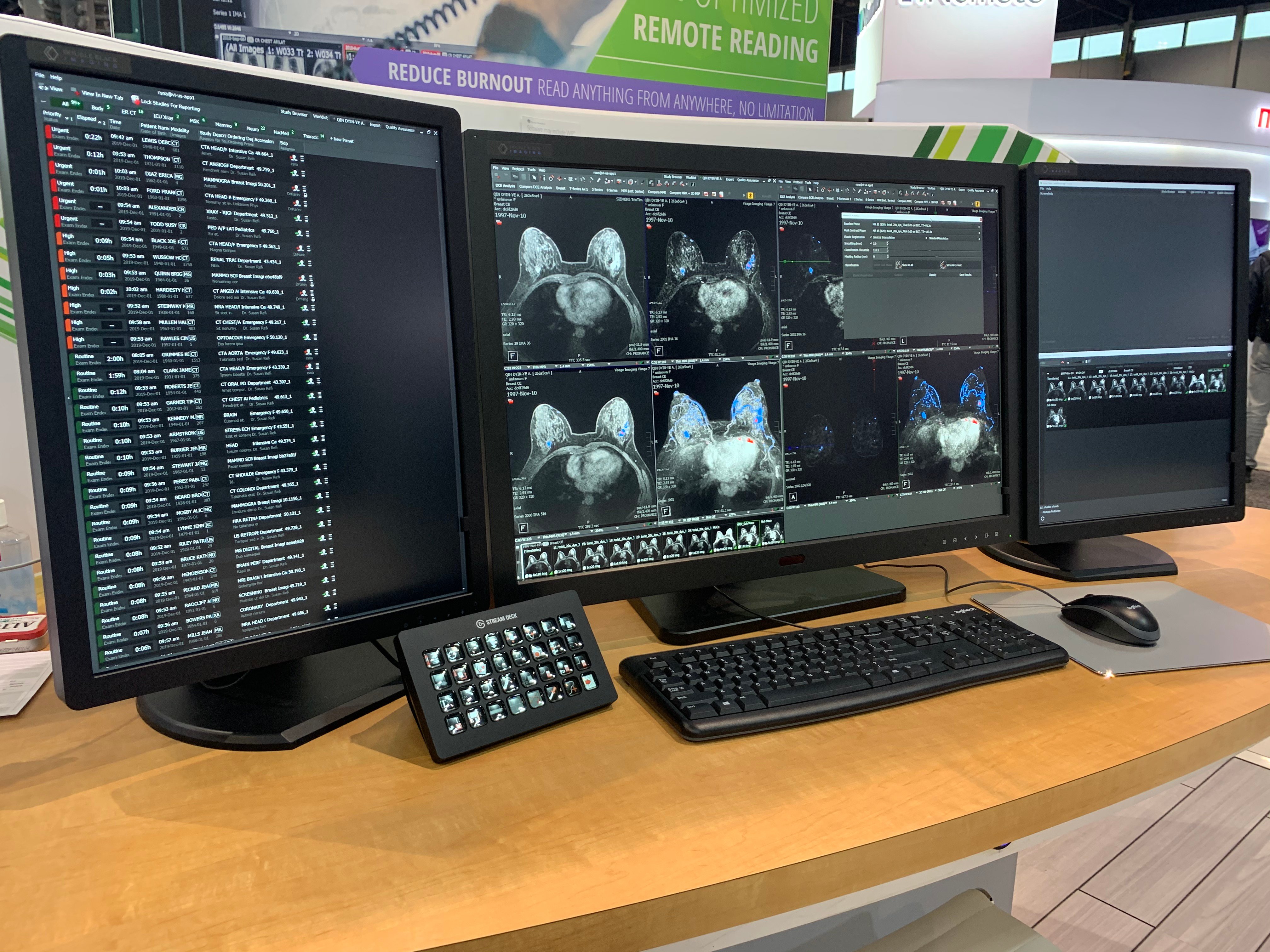 RSNA 2019 | Visage's Top Five