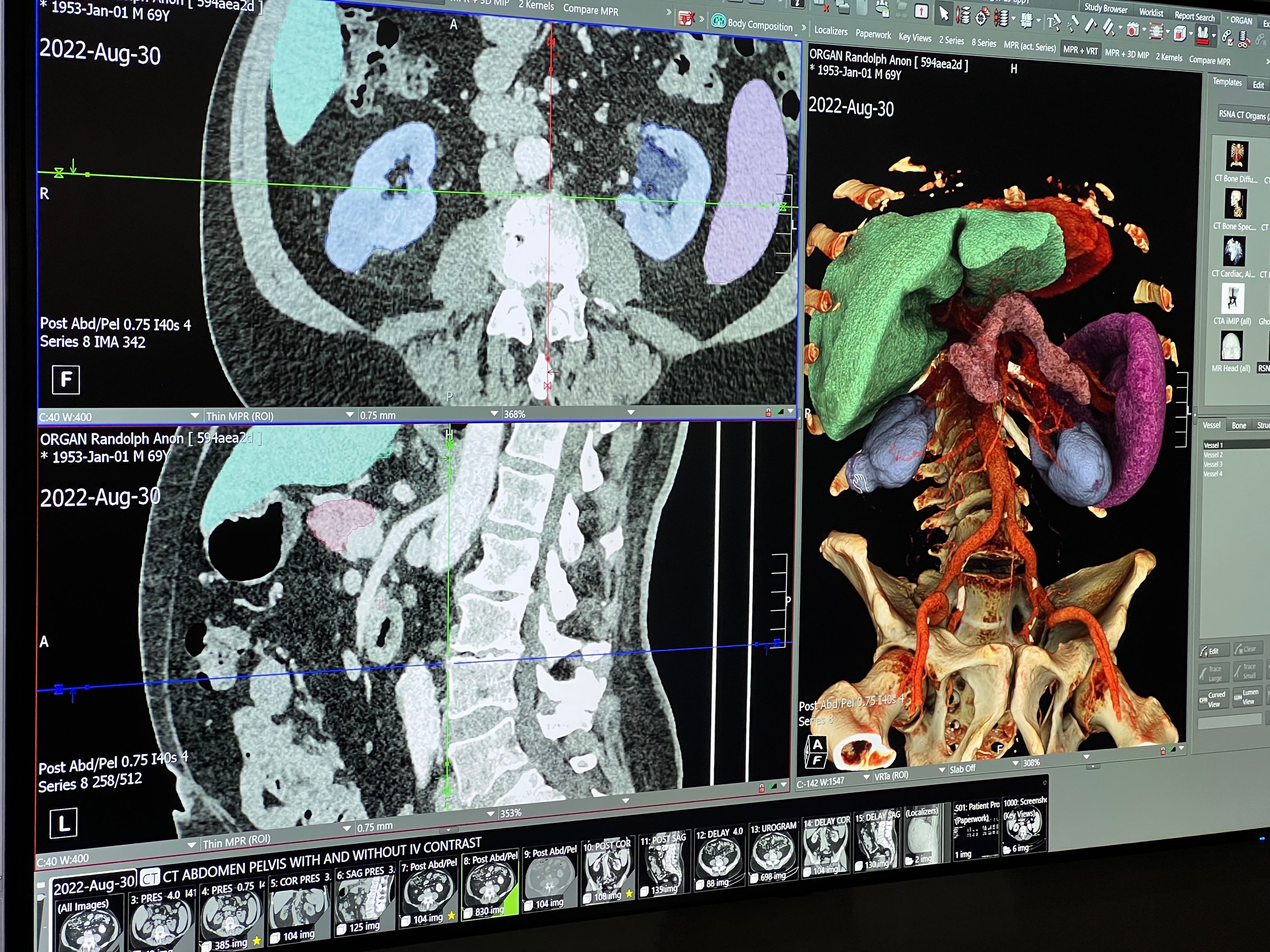 RSNA 2022 | Visage's Top Five