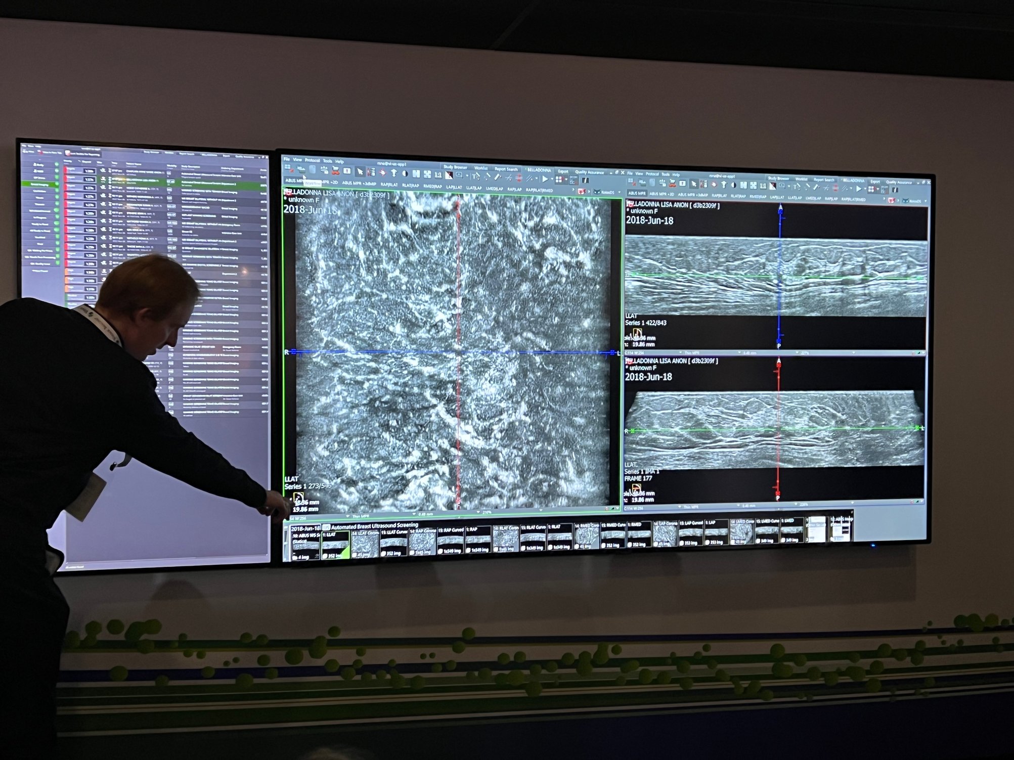 RSNA 2022 | Visage's Top Five