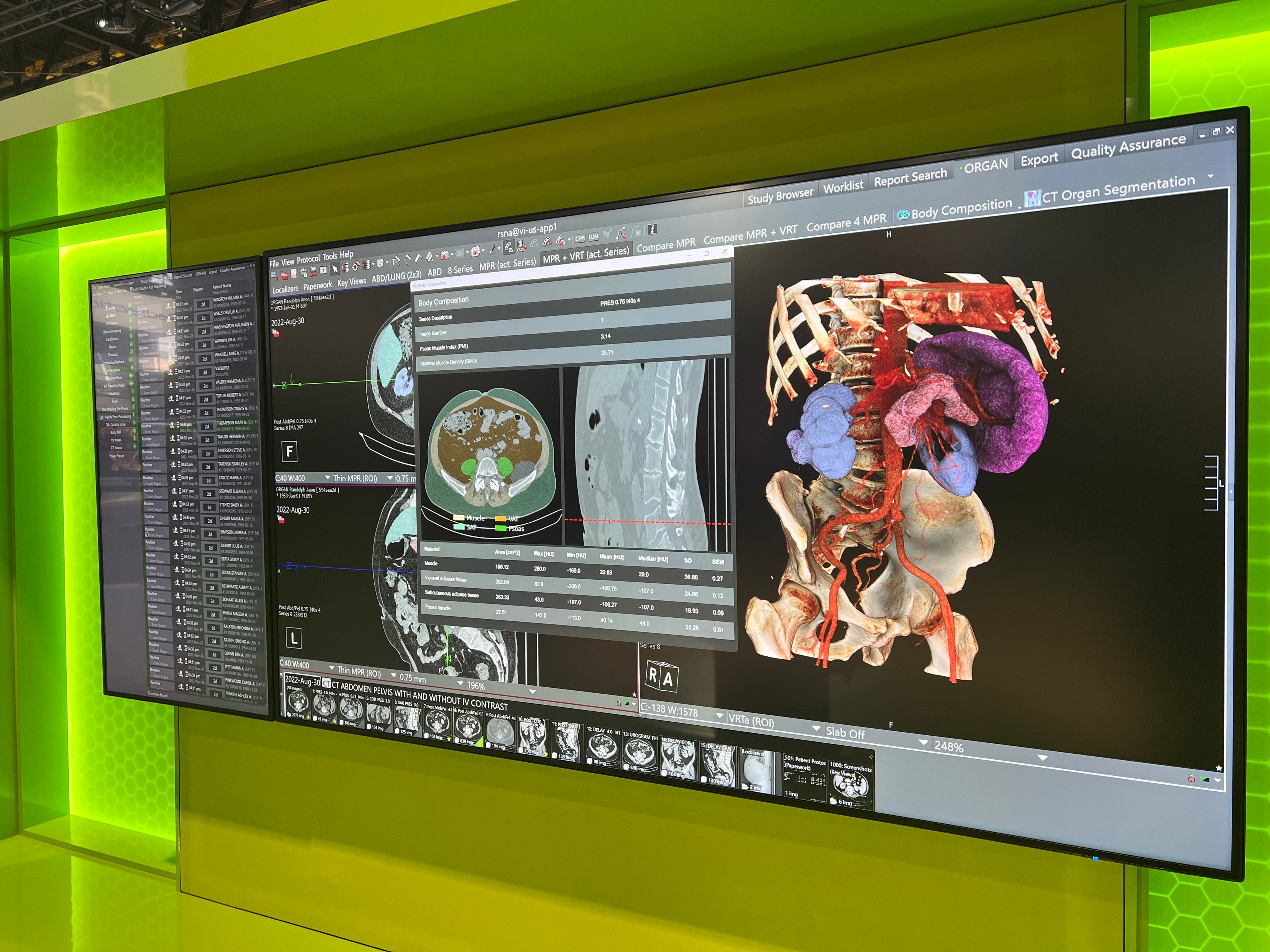 RSNA 2022 | Visage's Top Five