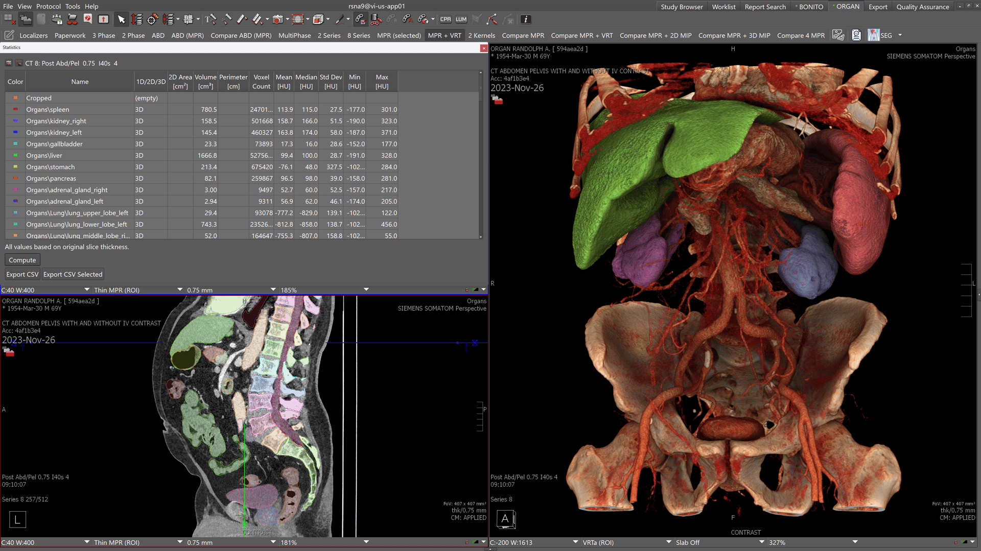 RSNA 2024 | Visage's Top Five