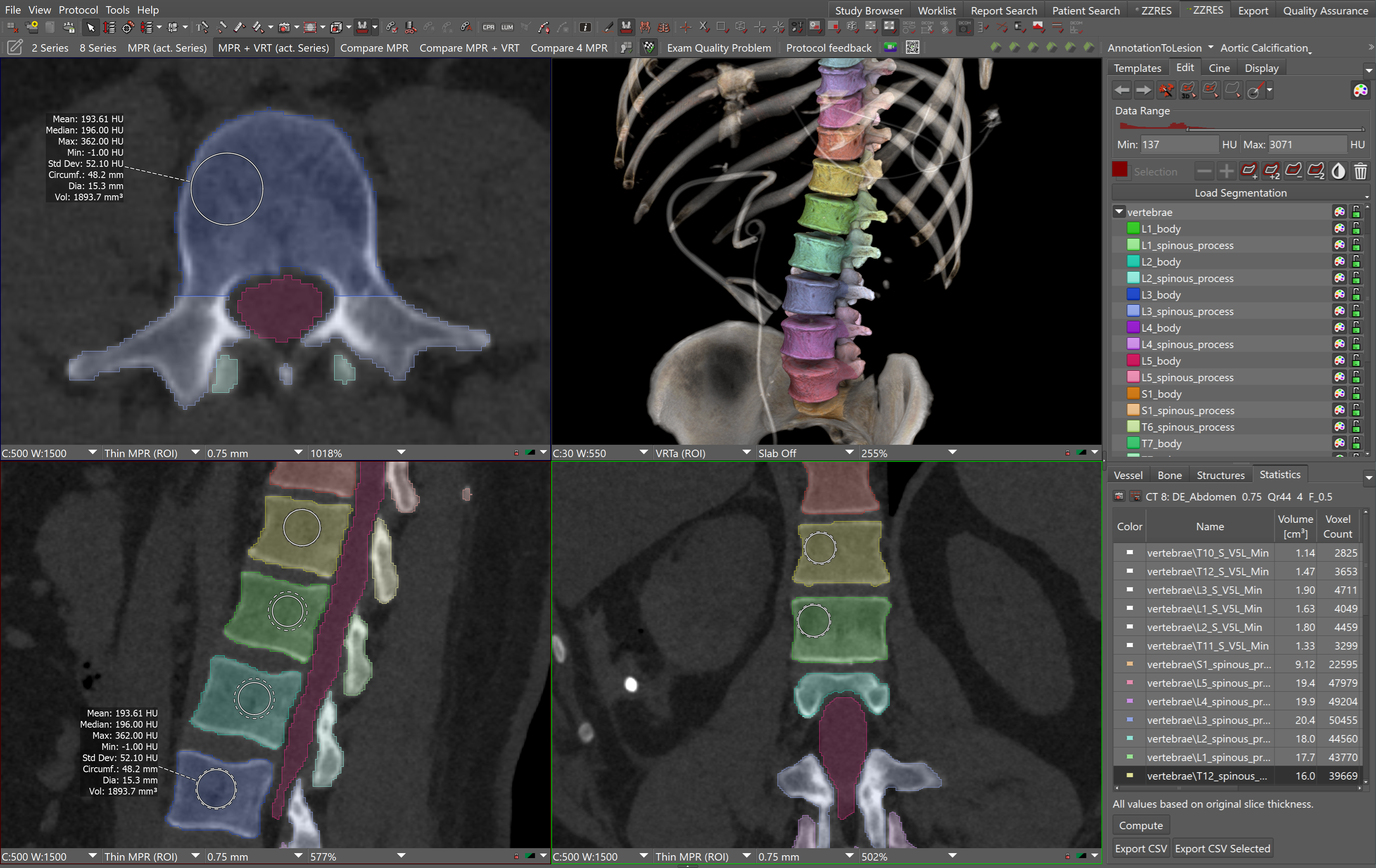 RSNA 2024 | Visage's Top Five