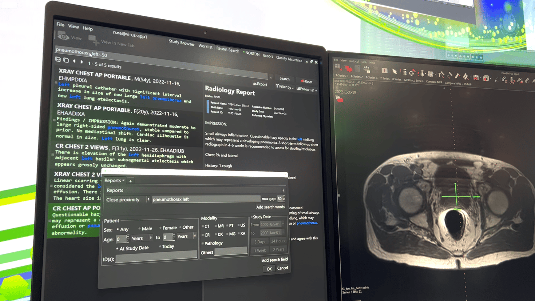 RSNA 2022 | Visage's Top Five