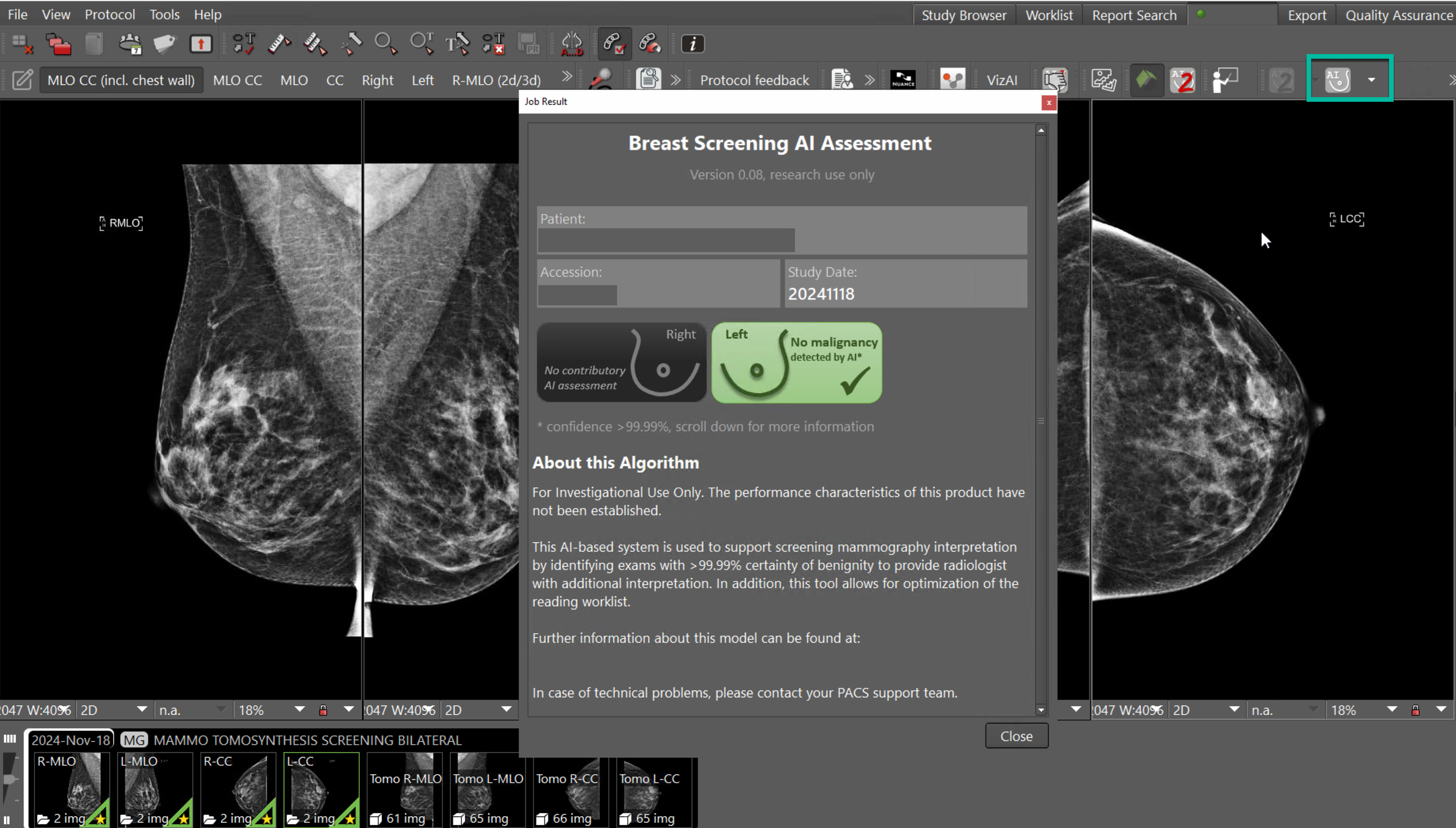 RSNA 2024 | Visage's Top Five