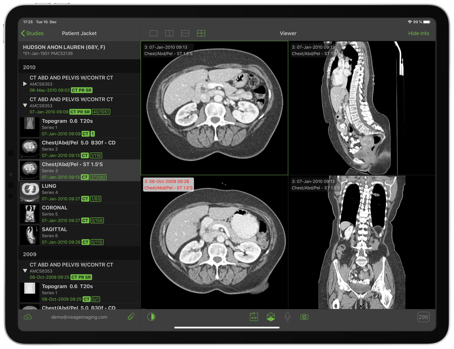 RSNA 2019 | Visage's Top Five